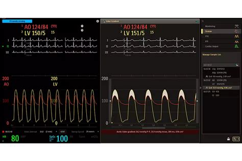 Philips Hemo With Intellivue X3 Interventional Hemodynamic Monitoring