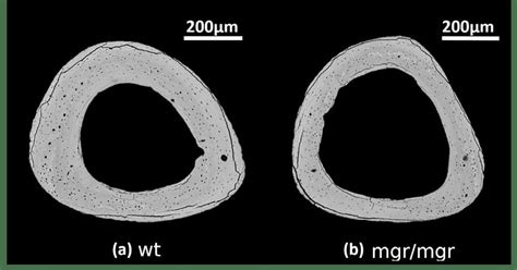8 representative maps of the calcium content in the cortex of a mice