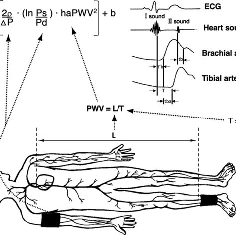 Schematic Illustration Of Cardio‐ankle Vascular Index Cavi Download Scientific Diagram