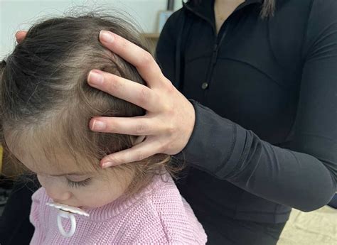 Cranial Osteopathy Hume Osteopathic Clinic