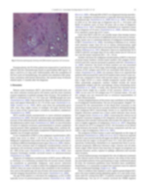 Solution An Ovarian Mature Cystic Teratoma Evolving In Squamous Cell Carcinoma A Case Report