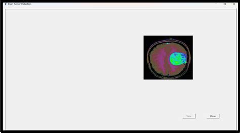 Github Elanchezhian2712 Brain Tumor Detection 🧠 Brain Tumor