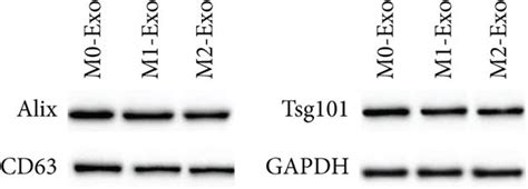 Macrophage Derived Exosome Characterization A Exosomes Were Isolated
