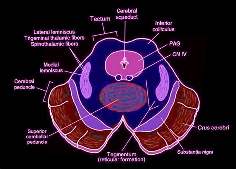 Neuroanatomy Edinger Westphal Nucleus Accessory Oculomotor Nucleus