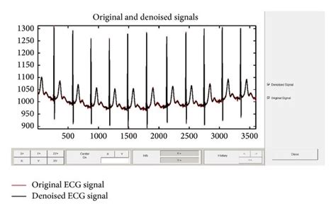 Original And Denoised Signals For Ecg Record No 103 M Using Download Scientific Diagram