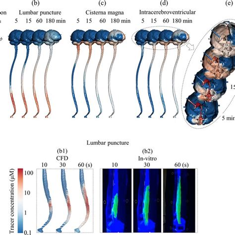 cfd results for 3d tracer concentration profiles versus time for lumbar