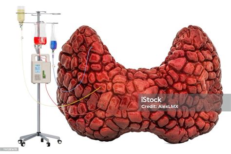 인간 갑 상선 정 맥 치료 시스템 갑 상선 질환의 치료 개념 흰색 배경에 고립 된 3d 렌더링 갑상샘에 대한 스톡 사진 및 기타