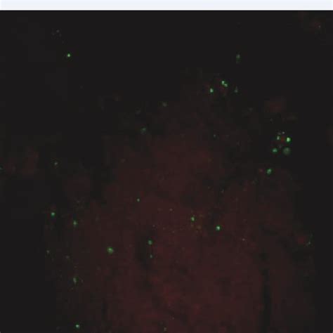 A Dfa Test Of A Brain Stem Impression From A Rabies Virus Infected Download Scientific Diagram