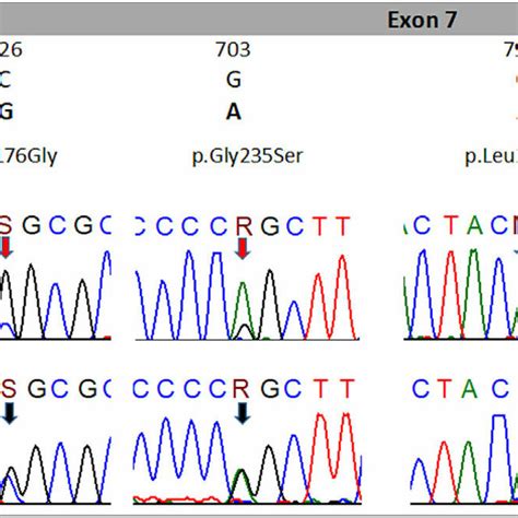 Data From Sequencing Of The Abo Gene Direct Sequencing Reveal Signals Download Scientific