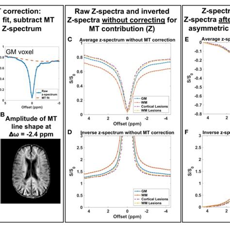 A A 2 Pool Lorentzian Model Was Fit To The Measured Z Spectrum Z Download Scientific
