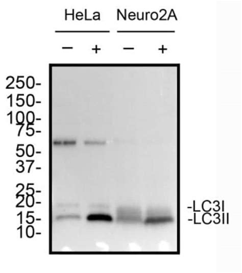 Lc3b Antibody 1251d Bsa Free Novus Biologicals 01mg Unlabeled