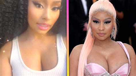 Nicki Minaj Breast Implants Before And After