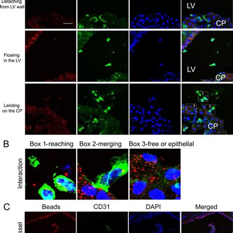 Commutation And Interaction Of Beads Ependymal Cells And The Choroid Download Scientific Commutation And Interaction Of Beads Ependymal Cells And The Choroid Download Scientific