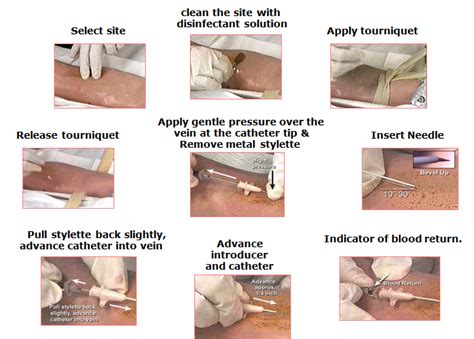 Intravenous Infusion Procedure