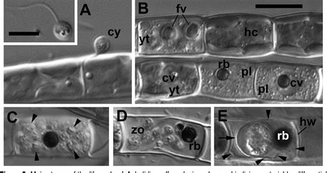 Figure 2 From Molecular Phylogeny And Ultrastructure Of Aphelidium Aff Melosirae Aphelida