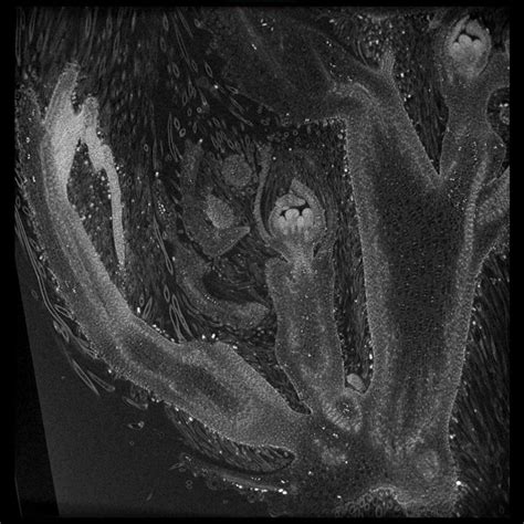 Advanced Reconstruction Technologies For X Ray Microscopy And Microct