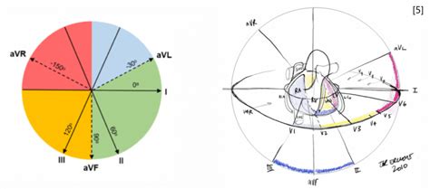ECG Basics Mind The Bleep