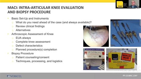 Surgical Best Practices For A Knee Arthroscopy And Maci Cartilage Biopsy