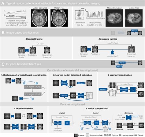 Deep Learning For Retrospective Motion Correction In Mri A