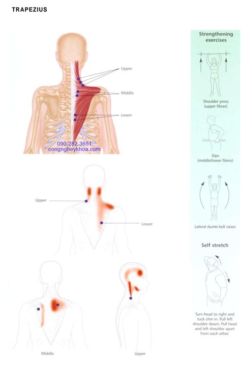 Trigger Point Là Gì Công Nghệ Y Khoa Mdt