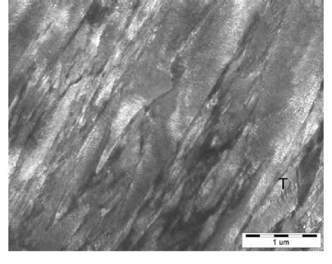 Tem Of Initial Microstructure Lath Martensitic Structure Is Developed Download Scientific
