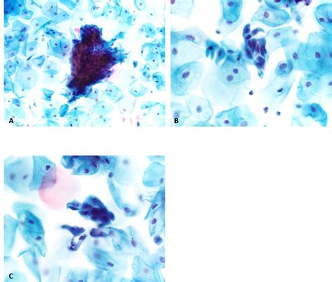 Cancer Cytopathology On Twitter As The Transgender Community Continues To Grow And There Is