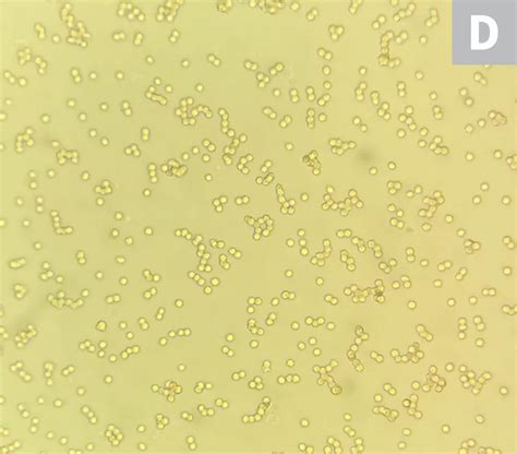 Use Of Crossmatching Prior To First Transfusion In Cats Clinicians Brief