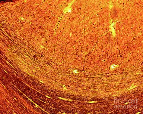 Pyramidal Cells In Cerebral Cortex 2 Photograph By Jose Calvo