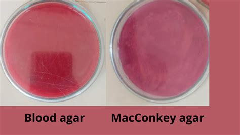 Staphylococcus Aureus Morphology Virulence Factors Lab Diagnosis