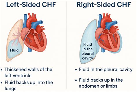 Enlarged Heart In Cats