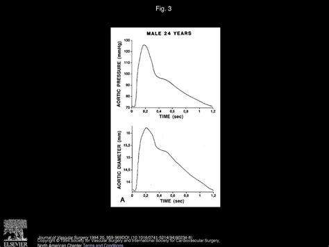 Sex difference in the mechanical properties of the abdominal aorta in human beings Björn