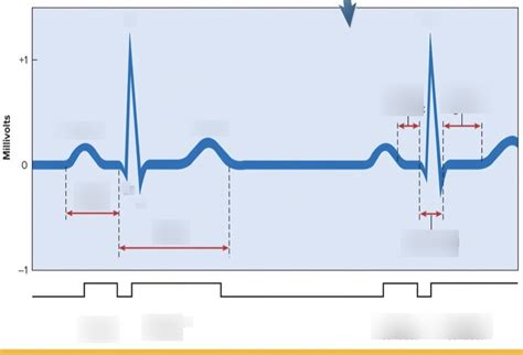 Biol 212 Electrocardiogram Diagram Diagram Quizlet