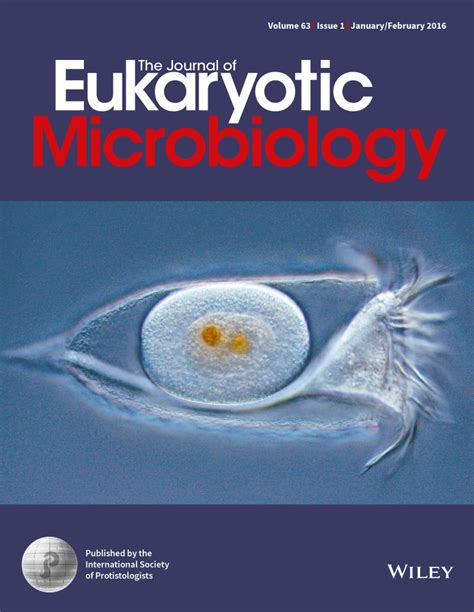 Journals Wiley Microbiology