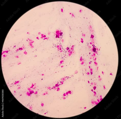 What Are Squamous Epithelial Cells In Gram Stain At Jeffery Thompson Blog