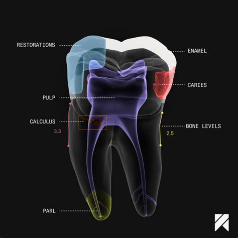 The Smilist Is Streamlining Dental Diagnosis With Overjet Ai