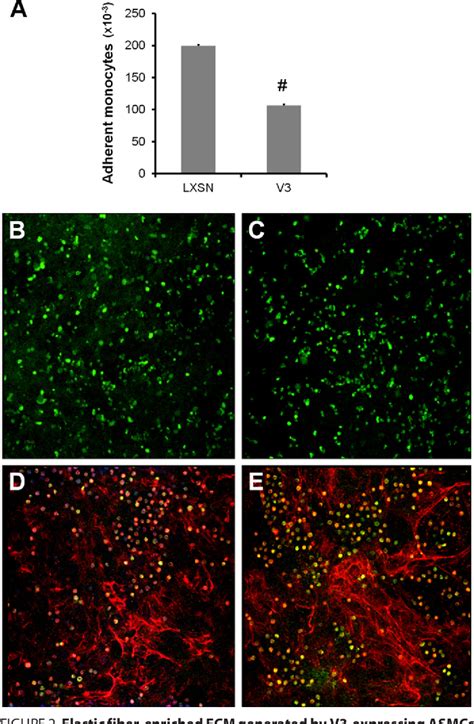 figure 2 from expression of versican v3 by arterial smooth muscle cells