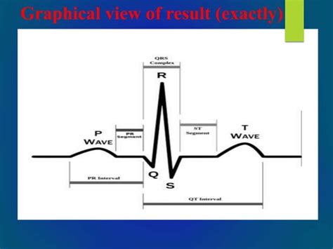 Real Time Monitoring Of Elctro Cardic Signals Using Arduino Ppt