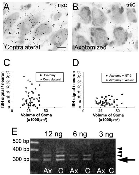 Analysis Of The Trkc Receptor Profile In Axotomized And Download
