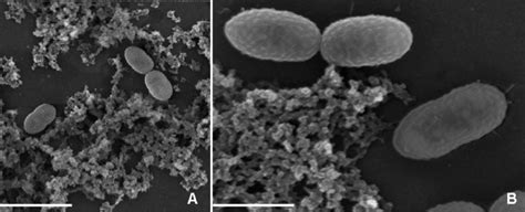 Interactions Between Milk Proteins And Exopolysaccharides Produced By