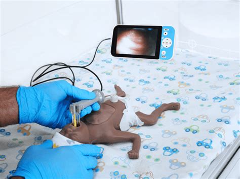 Neoview Video Intubation System