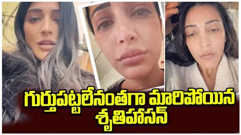 Shruti Hassan Without Makeup Pics Goes Viral What Happens To Actress