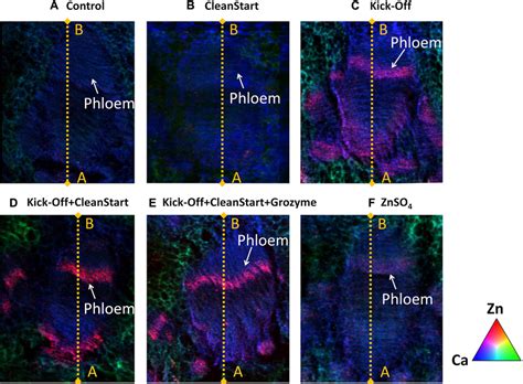 Micro X Ray Fluorescence Elemental Maps For Zn Red Ca Green And K Download Scientific