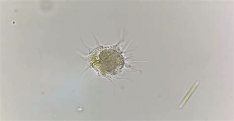 A Single Cell Organism Dying R Ajar Malaysia