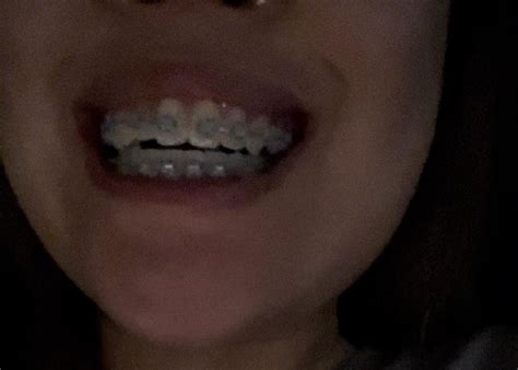 Halfway There 😁 Rbraces