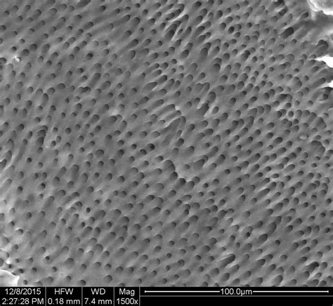 Dental Update Smear Layer Management In Endodontics An Update On