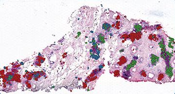 Focus On RNA Secondary Structure RNA Seq Blog