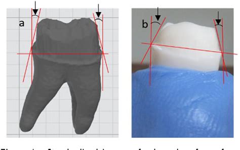 Figure 1 From Effect Of The Haptic 3d Virtual Reality Dental Training Simulator On Assessment Of