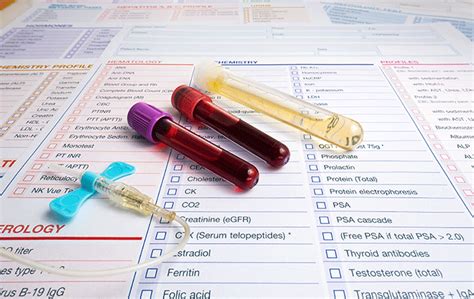 customizing lab requisition forms enhances sample tracking in