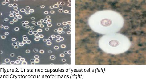 N Is For Negative Staining