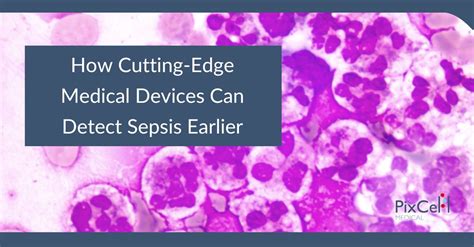 Pixcell Medical On Linkedin How Cutting Edge Medical Devices Can Detect Sepsis Earlier Pixcell…